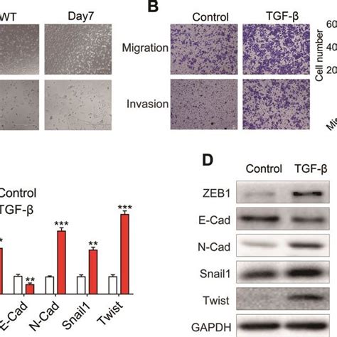 Identification Of The Emt Cell Model Based On Tgf β Treatment A