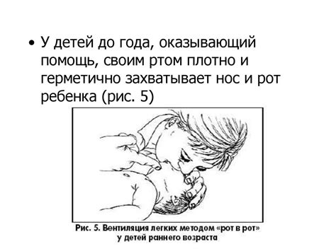 Особенности сердечно-легочной реанимации у детей - презентация онлайн