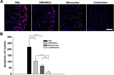 Hbm Mscs And Minocycline In Combination Reduce Apoptosis In Eae Mouse