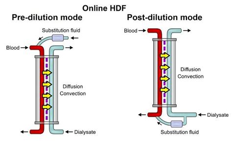 Dilution Control In Mergers At Jill Ford Blog