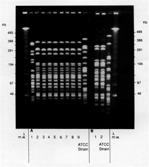 Pulsed Field Gel Electrophoresis Pattern Of 0 Anthropi A And