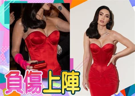 性感女神美瑾霍絲戴護腕套出席格林美懷疑受傷｜即時新聞｜繽fun星網｜oncc東網