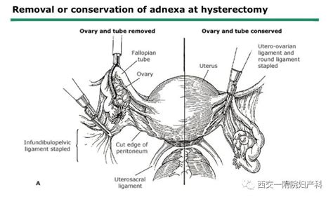 女性盆腔解剖图谱，妇产科医生要记得 医学界 助力医生临床决策和职业成长