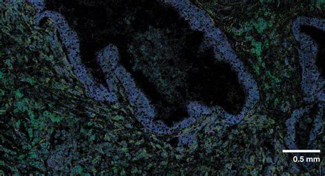 CosMx SMI Overview Single Cell Imaging NanoString