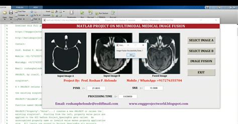 Multimodal Medical Image Fusion Using Matlab Project With Source Code Final Year Project