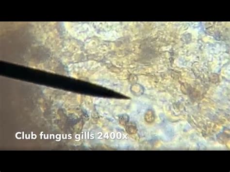 Lichen Under Microscope