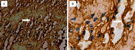 Factor Xa In Mesh Like Structure Arrow Dark Brown Factor Xa Was Found