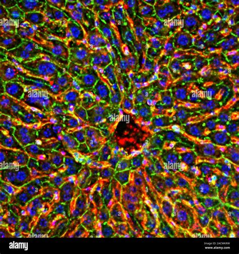 Liver Vein Fluorescence Deconvolution Micrograph Of A Section Through Liver Tissue Around A