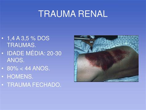 Ppt UrgÊncias TraumÁticas UrolÓgicas Powerpoint Presentation Free