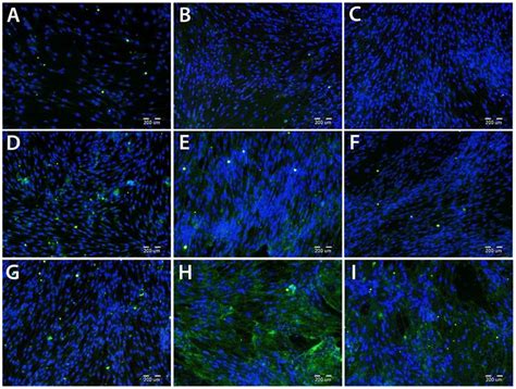 The Immuno Fluorescence Staining Of Osteocalcin Green And Cell Nuclei