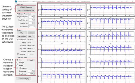 Playing Maternal And Fetal ECG Database Signals With MECG 2 0