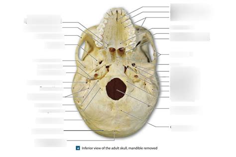 Inferior View Of The Adult Skull Diagram Quizlet