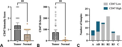 Cd47 Expression Levels A Cd47 Staining Intensity Scores P Value Was