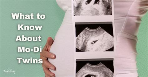What To Know About Monochorionic Diamniotic Twins Twiniversity 1