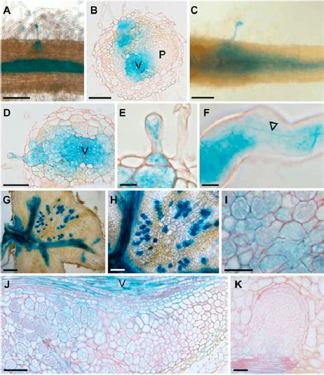 Cgaux1 Expression Pattern Upon Frankia Infection In C Glauca Cgaux1