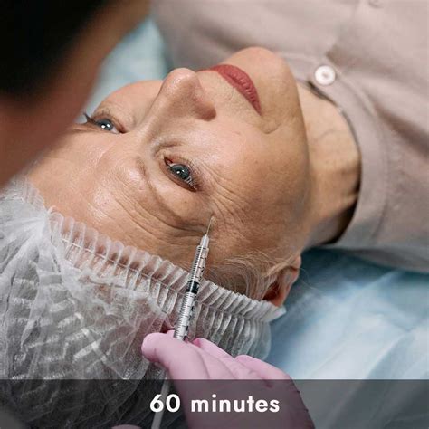 Juvederm Filler The Best Clinic Vredehoek Cape Town