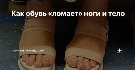 Как обувь «ломает ноги и тело Сам Себе Ортопед Спб Дзен