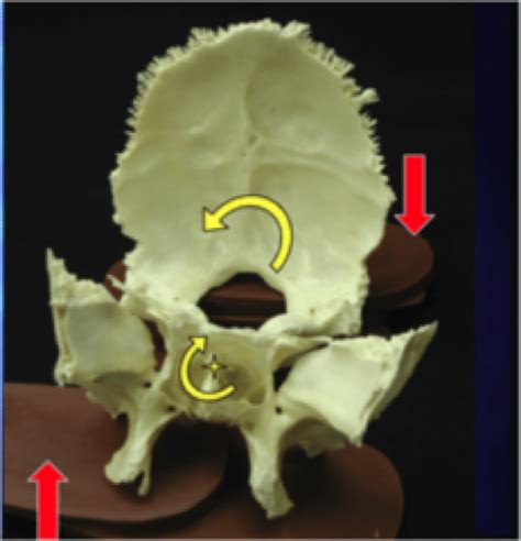 7 Somatic Dysfunction Of Sphenobasilar Synchondrosis Flashcards