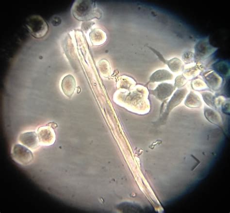 Unusual Structure In Uninfected Sf9 Cells Are They Contaminated