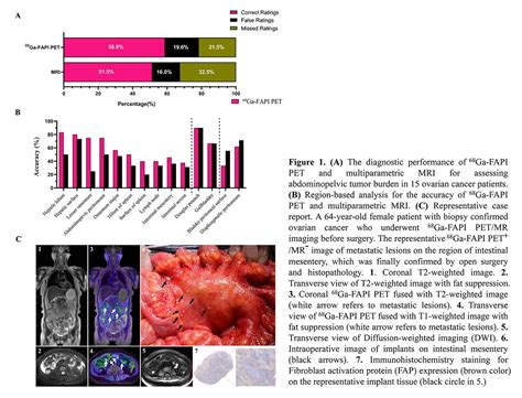 Comparison Of 68ga Fapi Pet And Multiparametric Mri In The Assessment