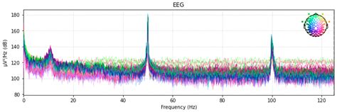 Electroencephalography Based Depression Detection Using Multiple