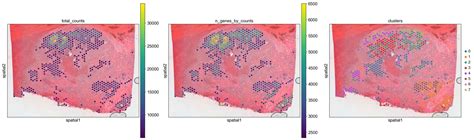 单细胞空间转录组分析流程学习python版三python 空间转录组 Csdn博客