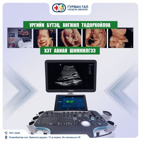 Гурван гал эмнэлэг Gurvan Gal Hospital 📌Жирэмсний 20 22 долоо хоногтойд 4d 5d хэт авиан
