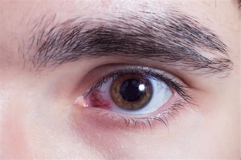 Dilated Pupils Drugs Drugs That Cause Pupils To Dilate