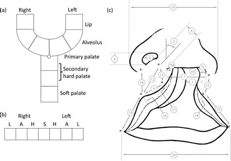 Unilateral Cleft Lip Principles And Practice Of Surgical Management Pmc