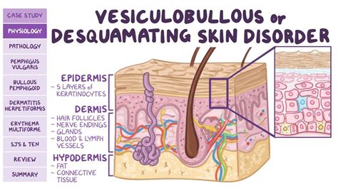 Vesiculobullous And Desquamating Skin Disorders Pathology Review Osmosis