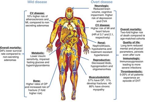 Adrenal Cushing S Syndrome Updates On Overt And Mild Hypercortisolism
