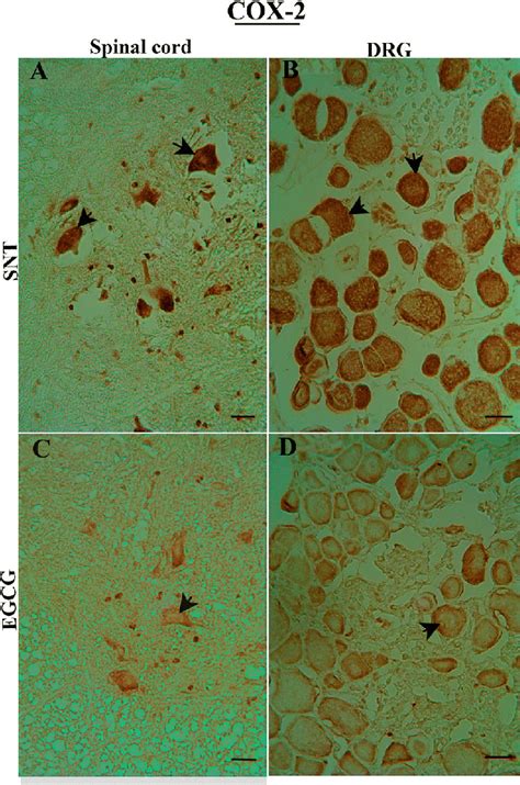 Light Photomicrographs Show Immunohistochemical Expression Of Cox 2 In