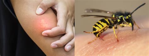 Do Wasps Sting Us For No Reason