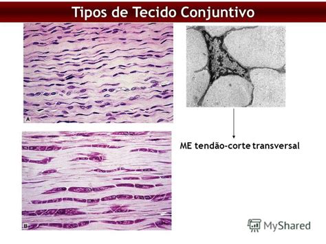 Презентация на тему Tecido Conjuntivo Definição Células