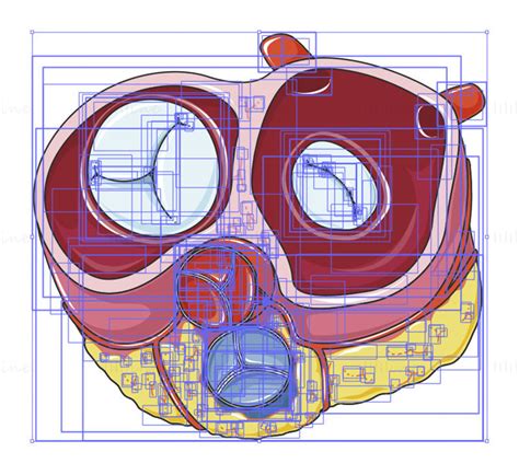 Mitral Valve Stenosis Vector