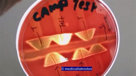 Streptococcus Agalactiae Archives Medical Notes