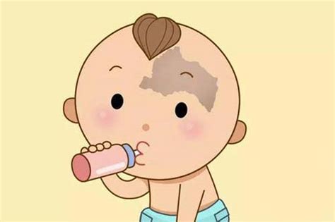 上海做激光去胎记一次多少钱 上海美莱整形医院