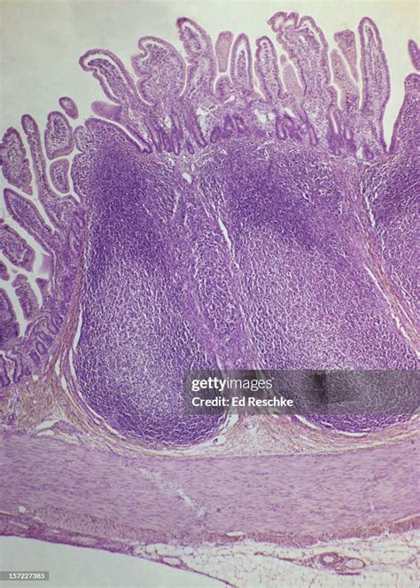 Ileum Histologie Peyerse Plekken 21 6 Small And Large Intestines
