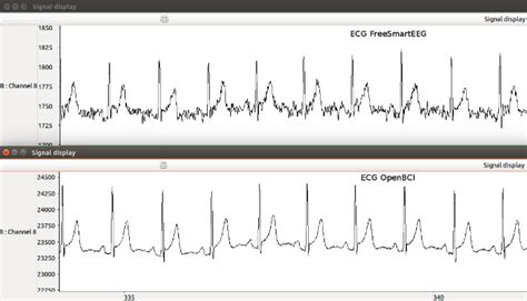 Comparison Of Electrocardiogram Ad7779 Freesmarteeg Vs Ads1299 Openbci