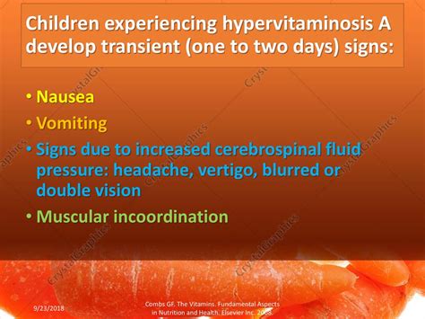 Vitamin A Toxicity Domina Petric Md Ppt Download