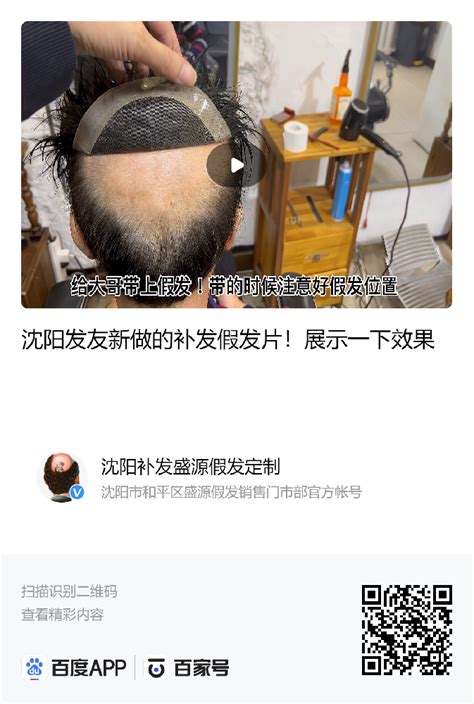 百家号最新 沈阳盛源cozy织发补发假发定制中心 沈阳假发补发织发定制服务专业店！
