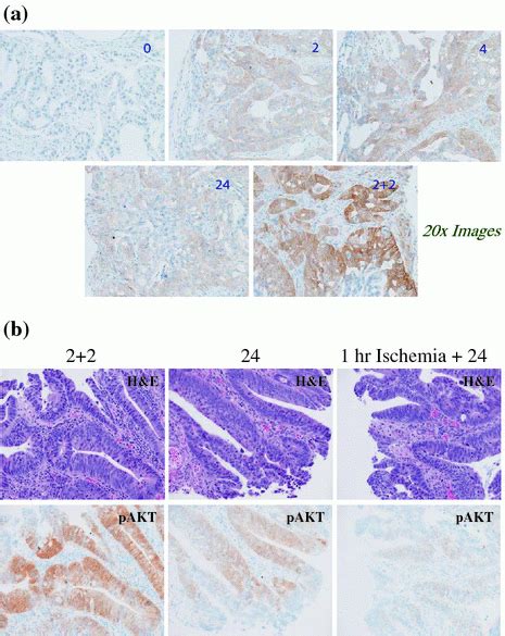 Formalin Fixation Preserves Activation States Efficiently Oncohema Key