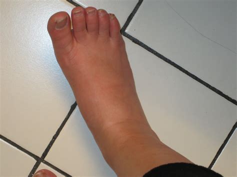 The Good Life Cankles