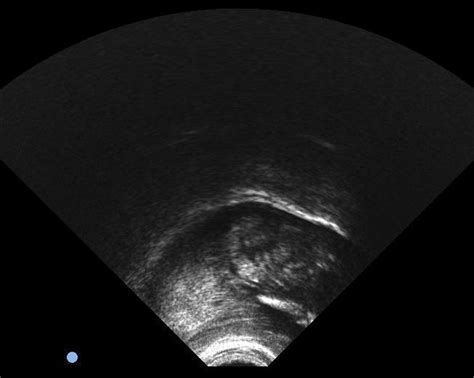 One 2d Ultrasound Tongue Image Recorded Download Scientific Diagram