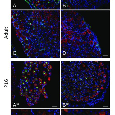 Non Neuronal Dnmt3a Signal In Adult Mouse DRG Does Not Overlap With