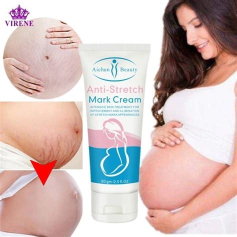 Aichun Beauty Anti Stretch Mark Cream 5yndlk