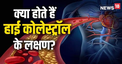 क्या कोलेस्ट्रॉल बढ़ने पर नज़र आते हैं लक्षण सच्चाई जानकर रह जाएंगे हैरान 5 टिप्स से हमेशा