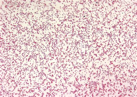 Photomicrograph Reveals Numerous Gram Negative Francisella Free Photo Rawpixel