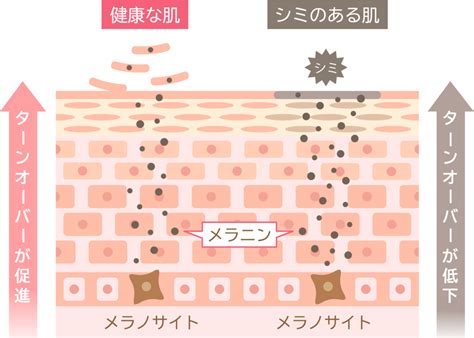【虫刺され】毛虫 に刺された時の症状 と対処法、痕にならない治し方について皮膚科医がわかりやすく解説【毛虫皮膚炎、チャドクガ、イラガ