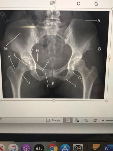 Hip Labeling Flashcards Quizlet